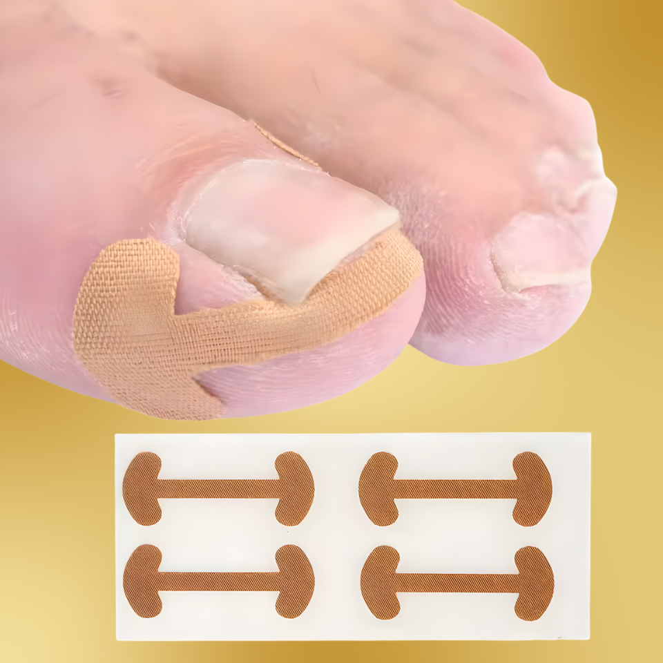 IngrowRescue™ Elastic Tabs – Aurece